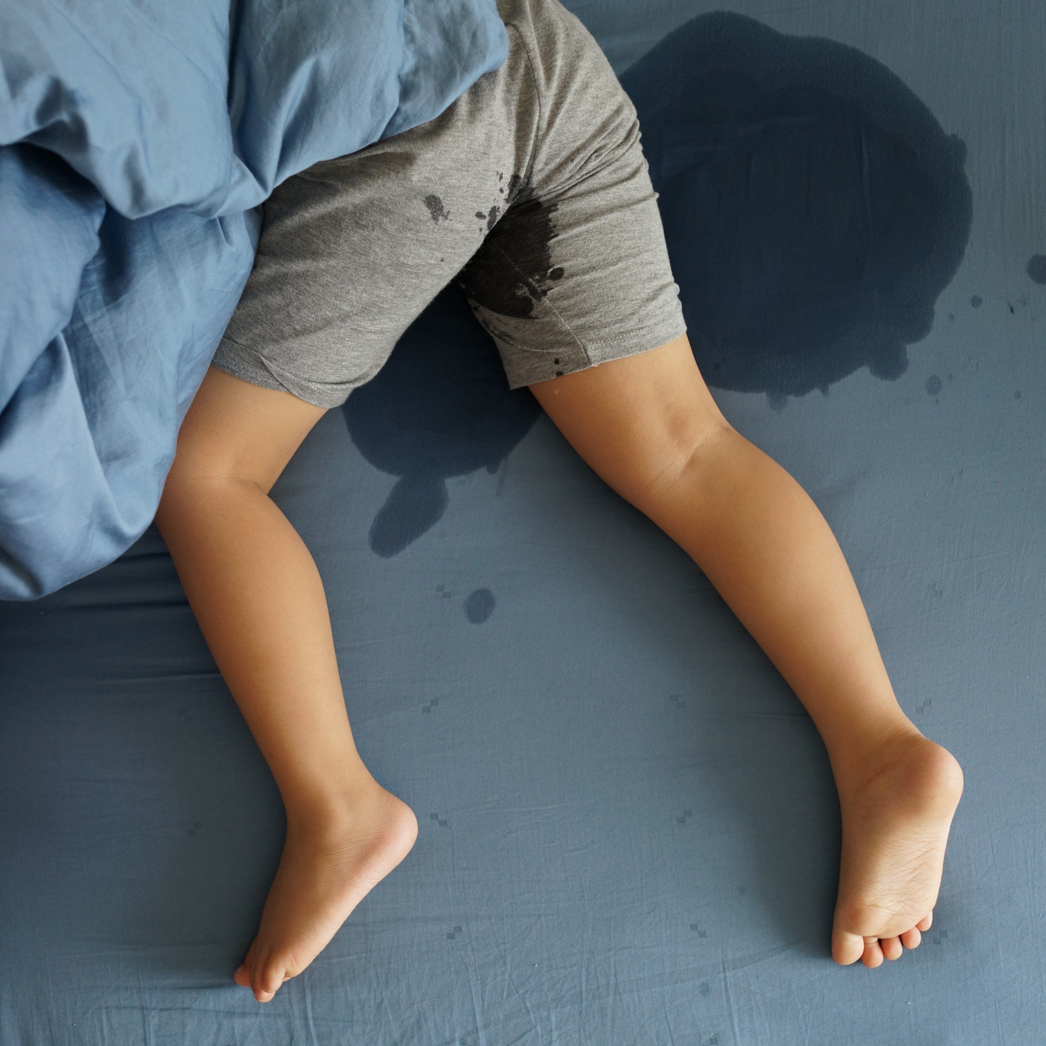 como-prevenir-o-xixi-na-cama-viver-com-sa-de-jornal-nh
