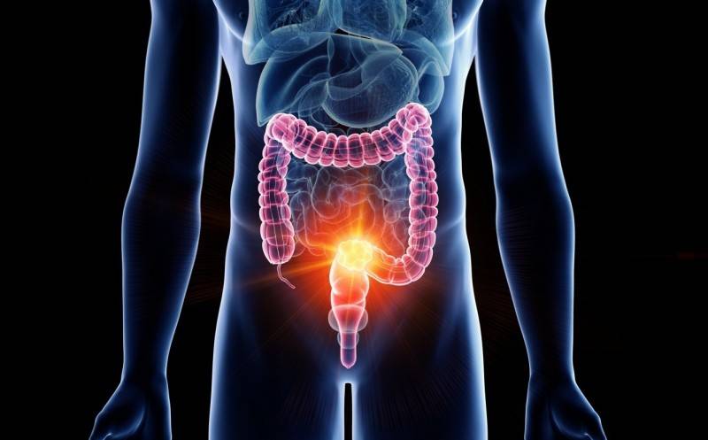 Câncer colorretal é cada vez mais comum a partir dos 40 anos - Viver ...