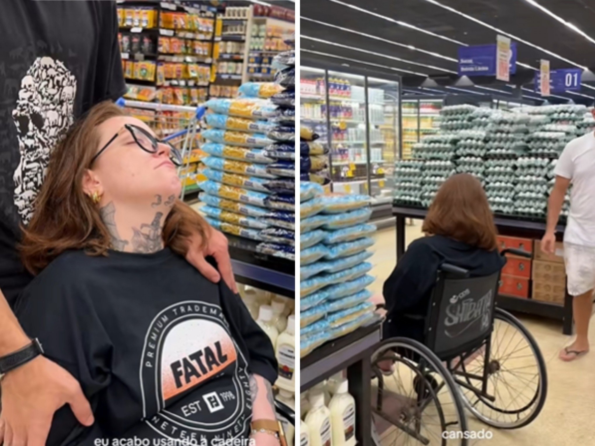 Espondilite anquilosante: Entenda o novo diagnóstico que fez mulher com ...